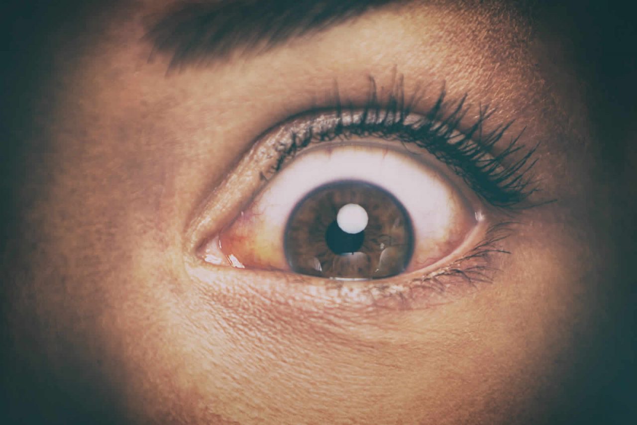What Illicit Drugs Cause Red Eyes? Signs of Substance Abuse